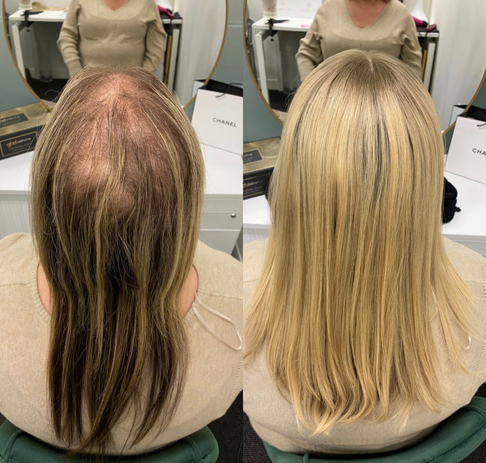 Before & After Photo Gallery – ND Hair Collection